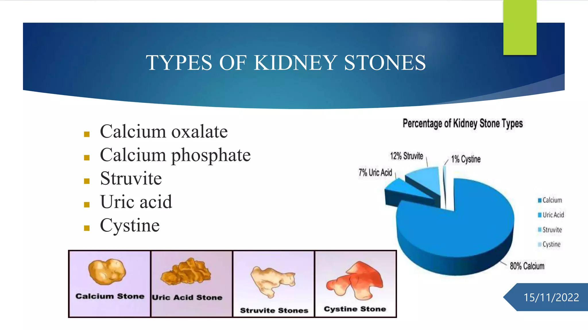 Kidney Stone.pptx
