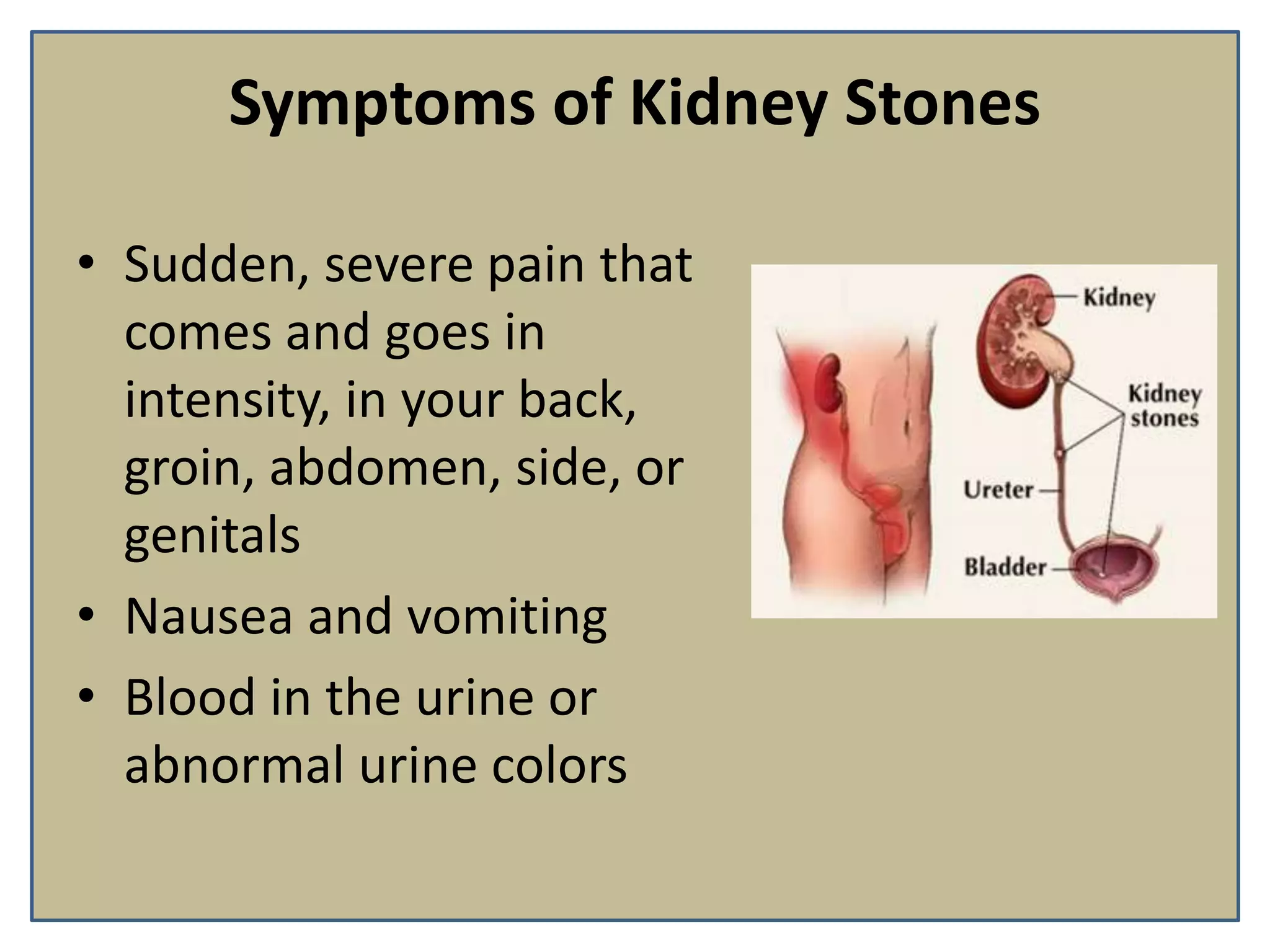 Kidneystone4 | PPTX