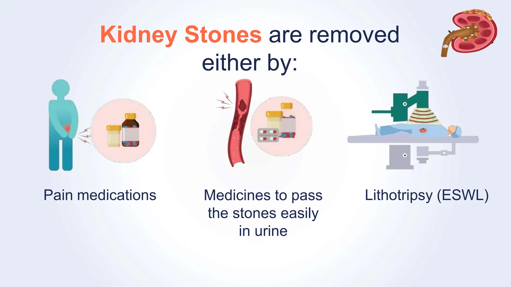 Kidney Stone Education for General - PPT English | PPTX | Digestive ...