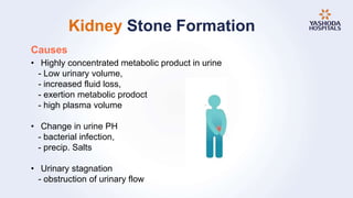 Kidney Stone Education for General - PPT English | PPTX | Digestive ...