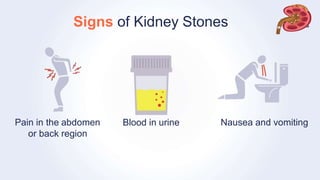 Kidney Stone Education for General - PPT English | PPTX | Digestive ...