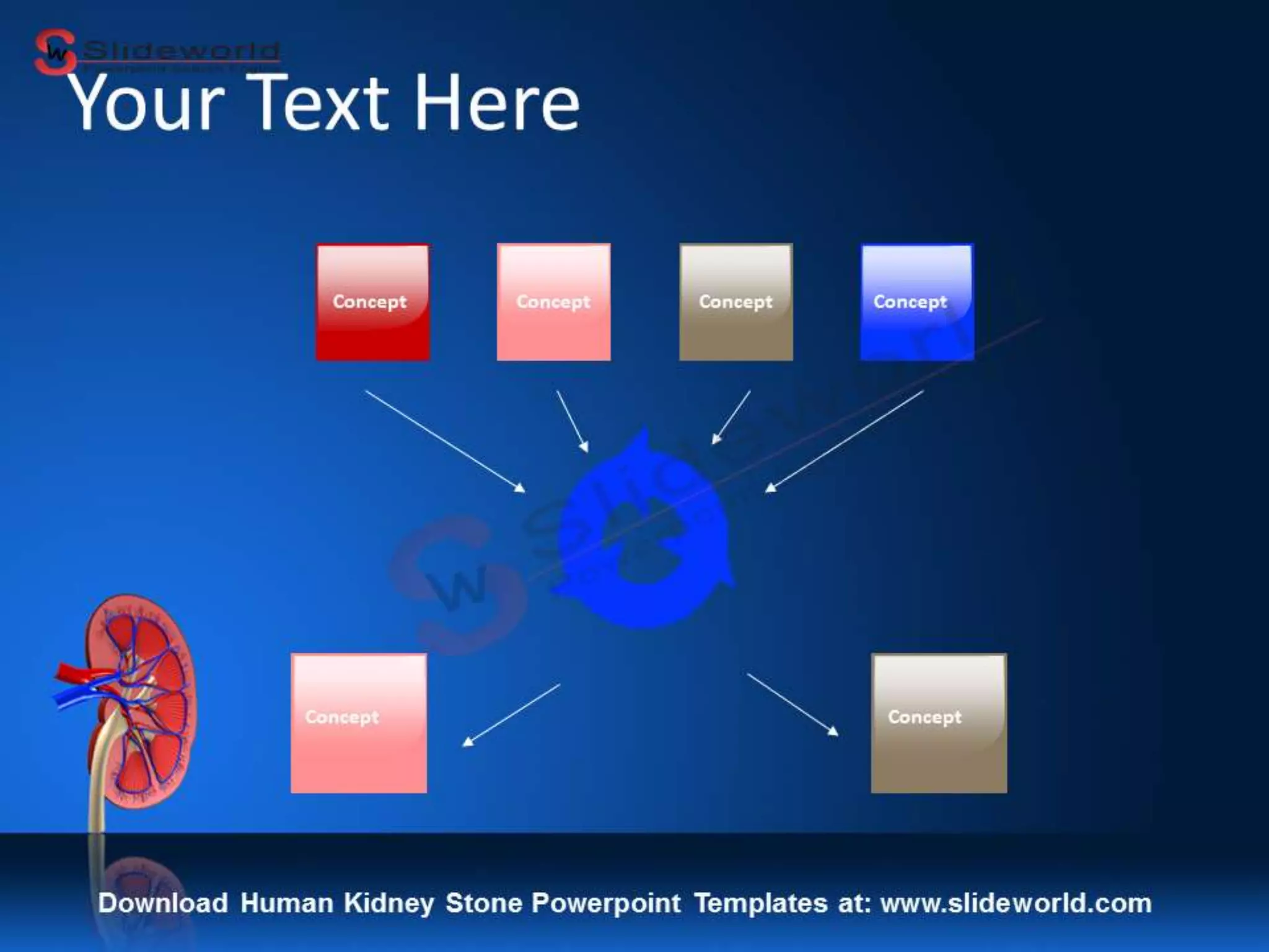 Human Kidney Stone Powerpoint Templates - SlideWorld | PPTX