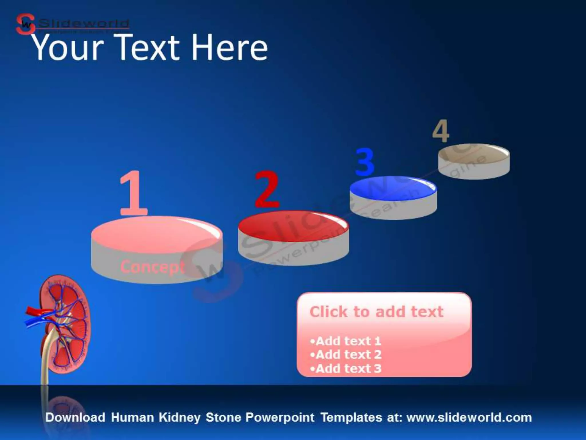 Human Kidney Stone Powerpoint Templates - SlideWorld | PPTX