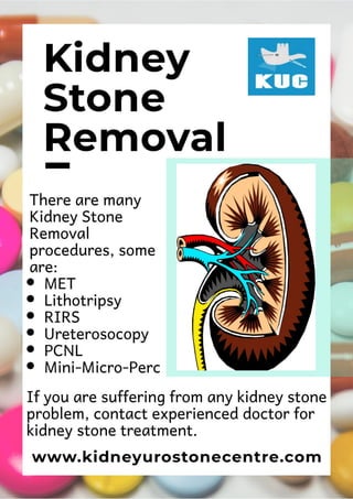 Kidney Stone Removal | PDF