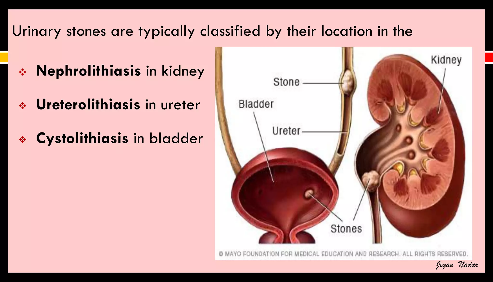 Pathophysiology of Kidney stones | PDF