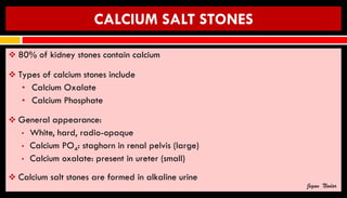 Pathophysiology of Kidney stones | PDF