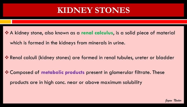 Pathophysiology of Kidney stones | PDF