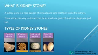 Kidney Stones Treatment in South Jersey. | PPTX