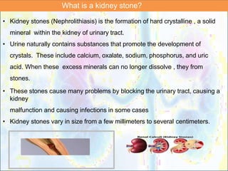 kidney stones types, complications, symptoms | PPTX
