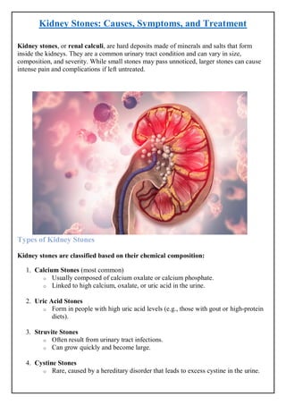Kidney Stones: Causes, Symptoms, and Treatment | PDF