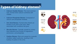 Kidney Stones Causes, Symptoms and treatment options.pptx