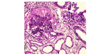 RENAL pathology For post graduates in pathology by Dr. Nancy Gupta pptx ...