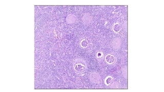 RENAL pathology For post graduates in pathology by Dr. Nancy Gupta pptx ...