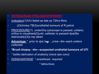 Kidney to uretrocele | PPT