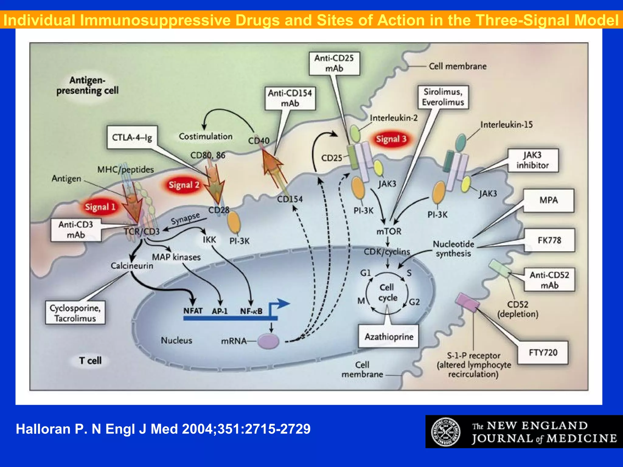Management of Renal Transplant Patients | PPT