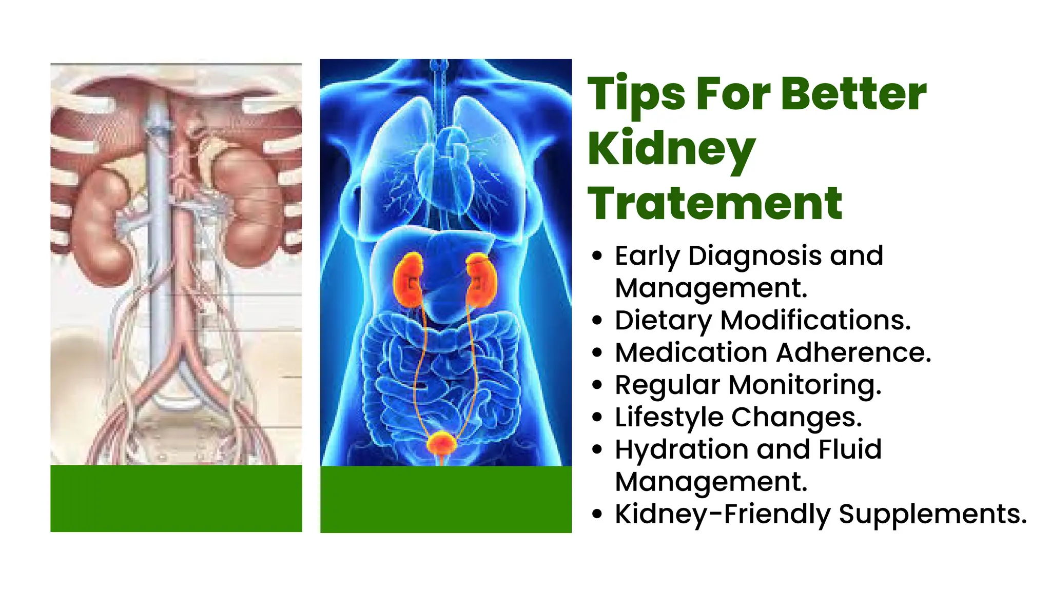 Kidney Transplant At Hiranandani Hospital | PDF | Surgery | Medical Health