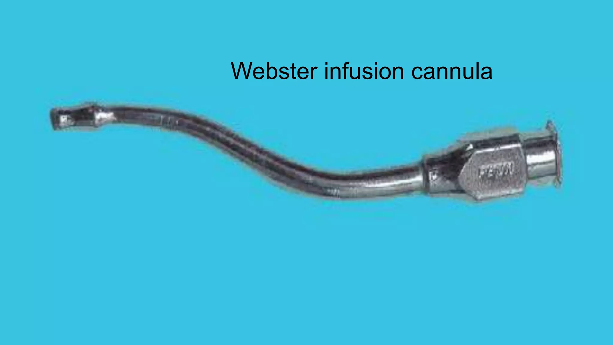 Kidney transplantation | PPTX