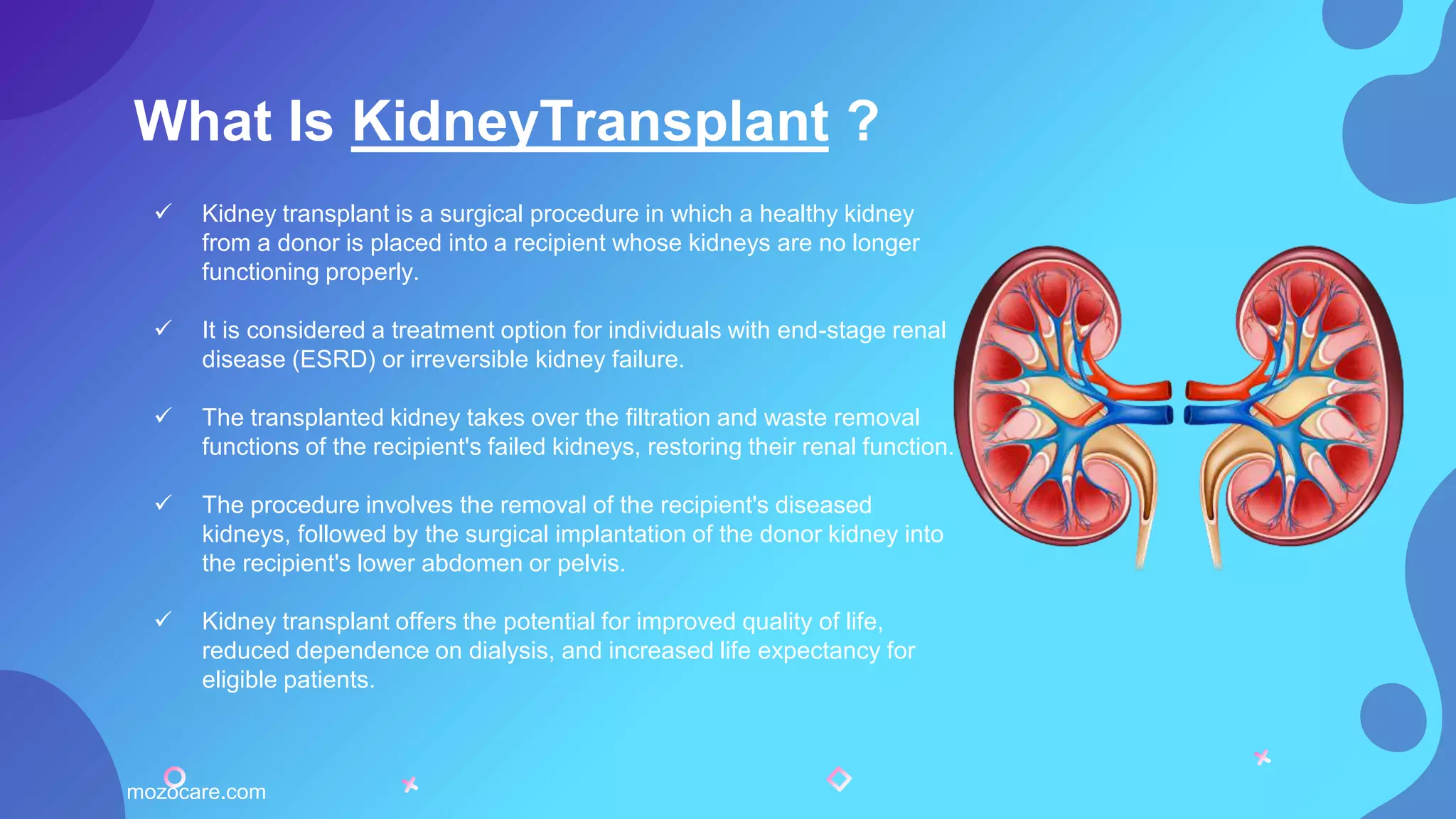 Know More About Kidney Transplantation | PPT