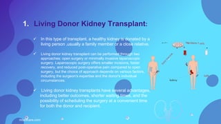 Know More About Kidney Transplantation | PPTX