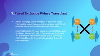 Know More About Kidney Transplantation | PPT