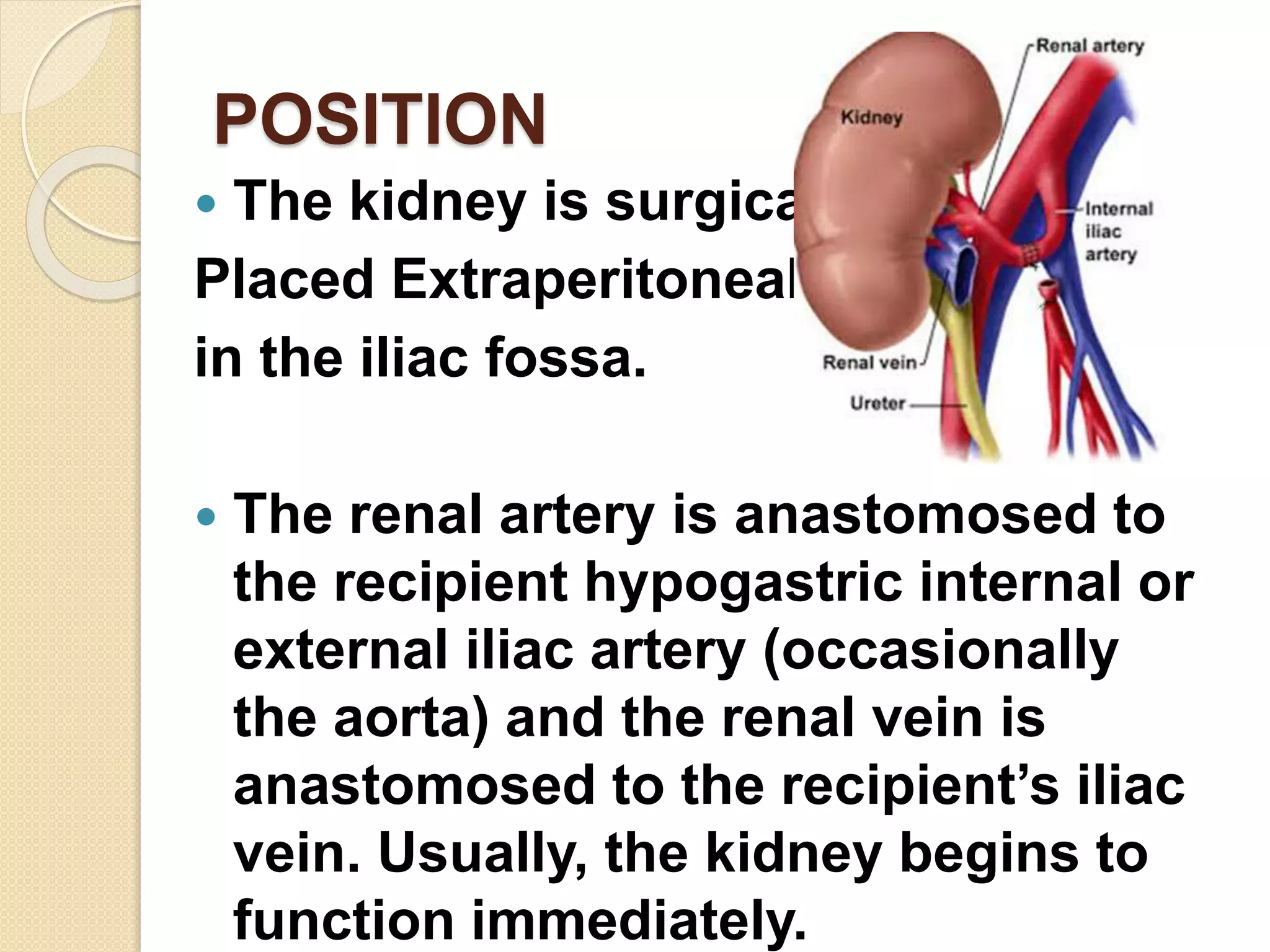 Kidney trnaplantaion | PPTX