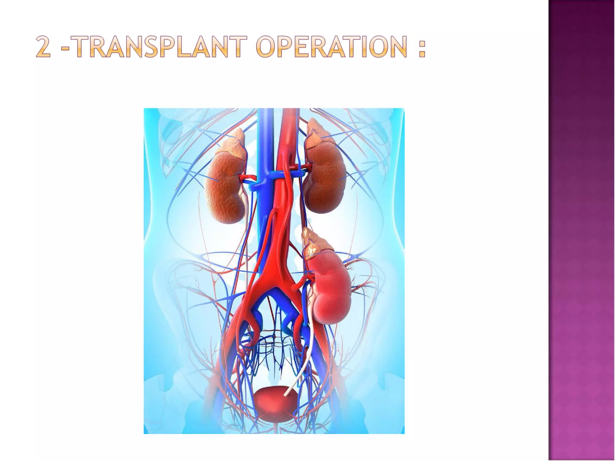 Kidney transplantation power point | PDF