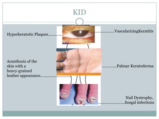 Vohwinkel Syndrome vs. KID Syndrome | PPTX