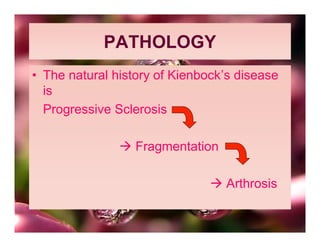Kienbock Disease | PDF