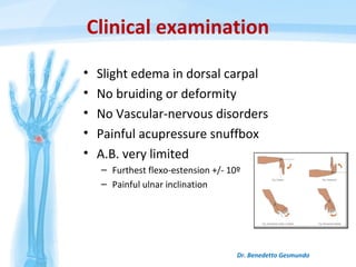 Kienbock disease | PPT