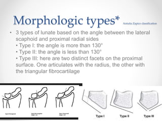 Kienbock's disease | PPTX | Death, Injury, or Military Conflict ...