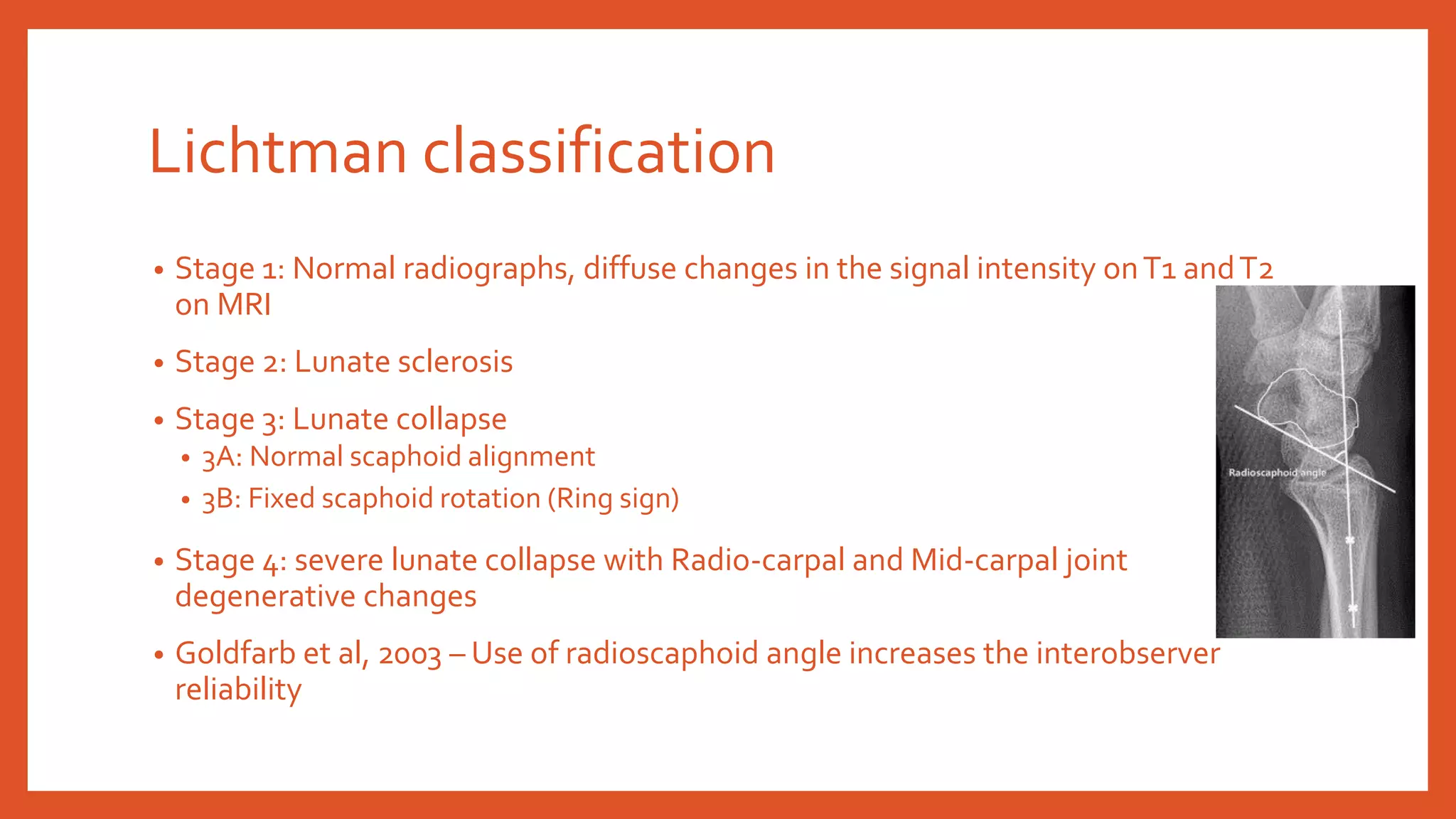 Kienbocks disease kiran kumar naikoti | PDF