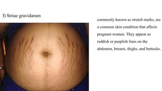 Complications with all associated notes .pptx