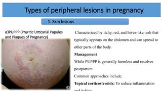 Complications with all associated notes .pptx