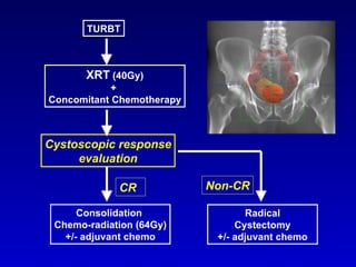 Bladder-Sparing Trimodality Therapy for Muscle-Invasive Bladder Cancer ...