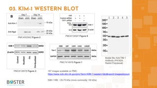 Learn KIM1/TIM1/HAVCR1 in 3 minutes | Kidney injury molecule 1 | PPT