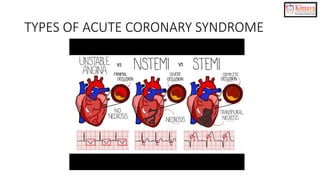 ACUTE CORONARY SYNDROME AND ITS BASICS WITH SYMPTOMATOLOGY AND PRIMARY ...