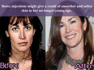 Robin Meade Before And After Plastic Surgery