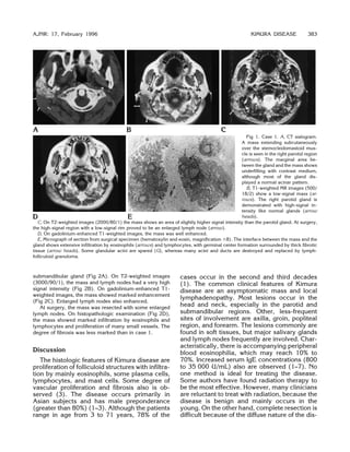 Kimura's disease ct and mr findings | PDF