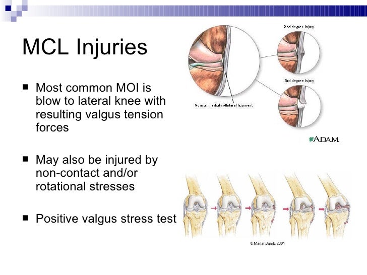 Kin 188 Knee Injuries And Evaluation