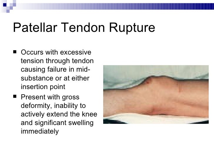 Kin 188 Knee Injuries And Evaluation