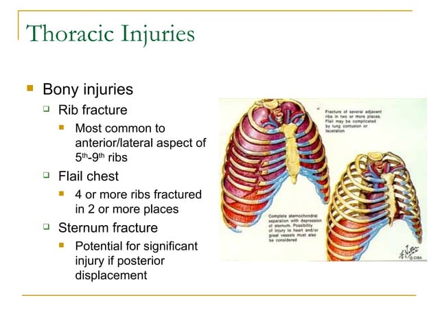 Kin 188 Thoracic And Abdominal Evaluation And Injuries | PPT | Death ...