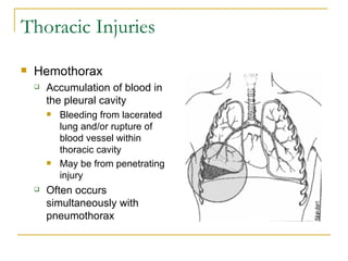 Kin 188 Thoracic And Abdominal Evaluation And Injuries | PPT