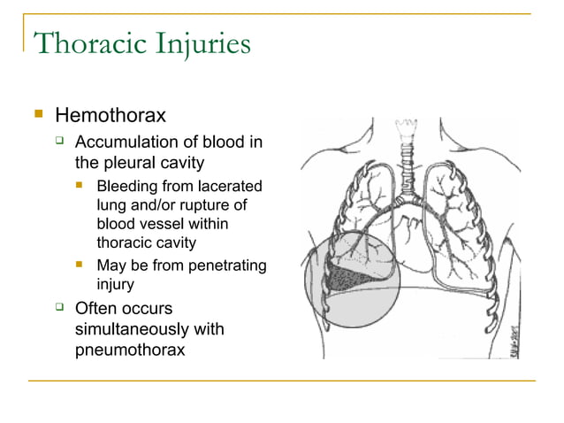 Kin 188 Thoracic And Abdominal Evaluation And Injuries | PPT | Death ...