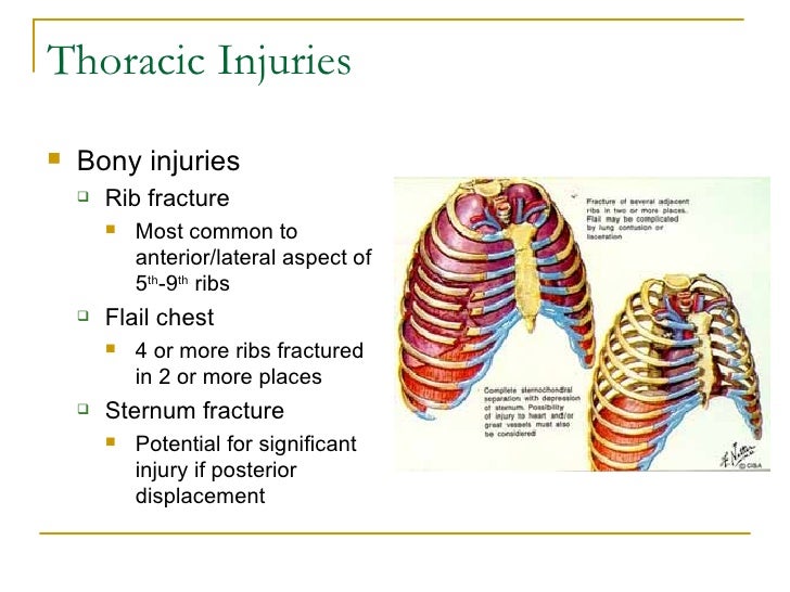 Kin 188 Thoracic And Abdominal Evaluation And Injuries