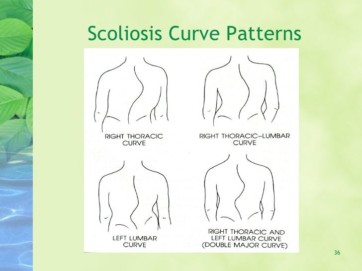 Kin191 A. Ch.3. Assessment Of Posture. Fall 2007