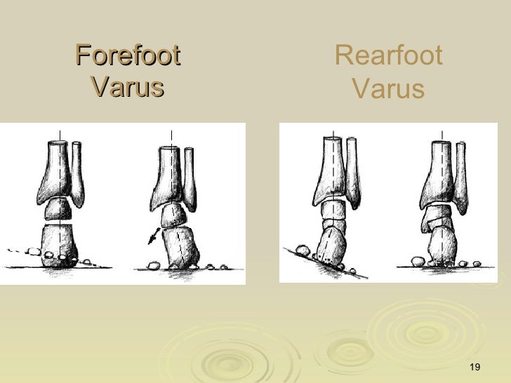 Kin191 A. Ch.4. Foot. Toes. Evaluation. Fall 2007