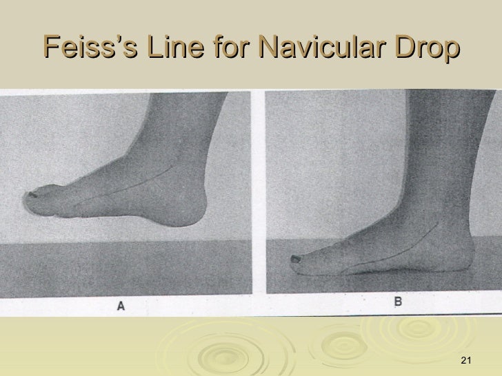 Kin191 A. Ch.4. Foot. Toes. Evaluation. Fall 2007