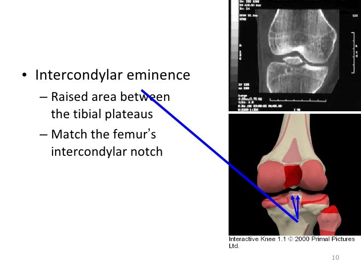 Kin191 A.Ch.6.Knee.Patellofemoral.Anatomy