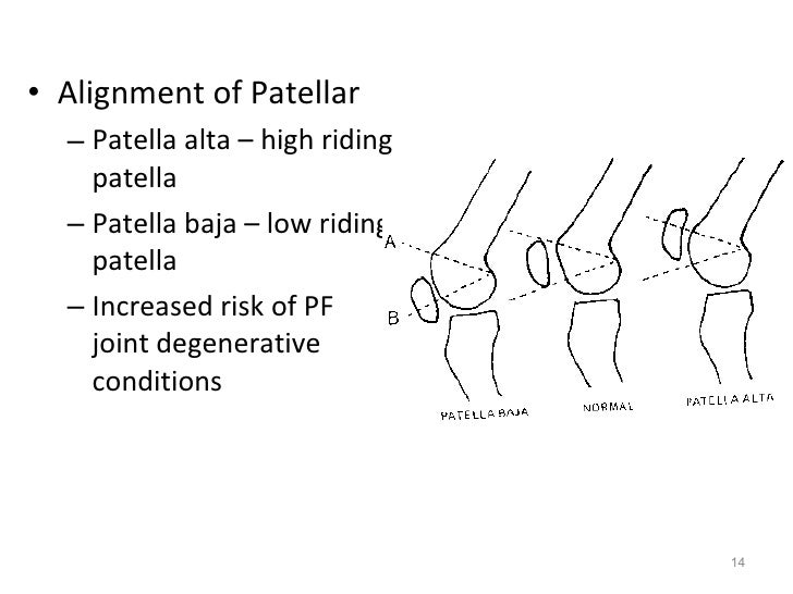 Kin191 A.Ch.6.Knee.Patellofemoral.Evaluation