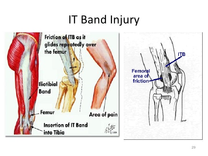Kin191 A.Ch.6.Knee.Patellofemoral.Injuries